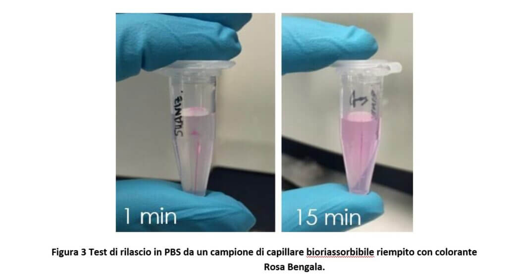 Fibre ottiche bioriassorbibili: le prospettive in campo medico - Agenda ...